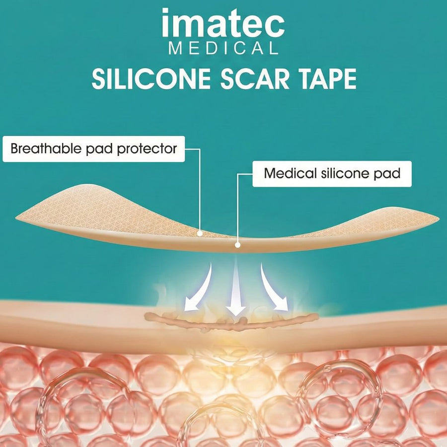 Silicone Scar Tape (4cm x 1.5m) Natural Beige by Imatec Medical ...