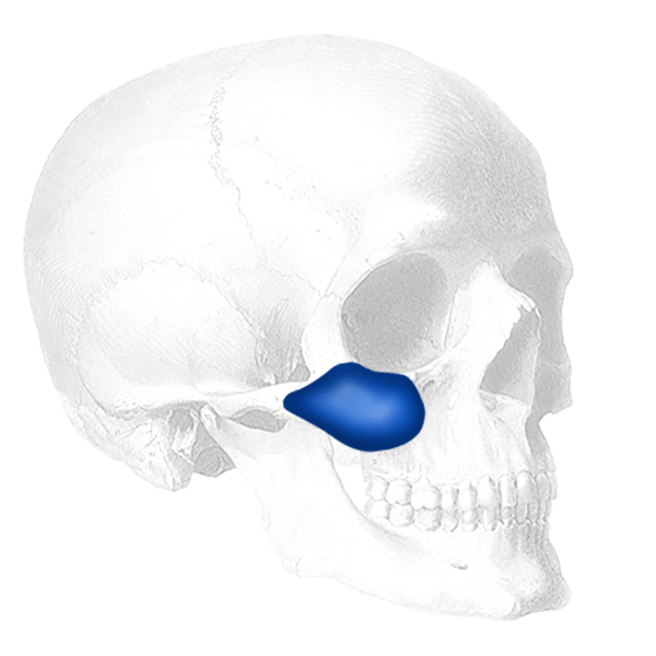 Implantech Combined Submalar Shell™ Facial Implant (Sold in Pairs ...