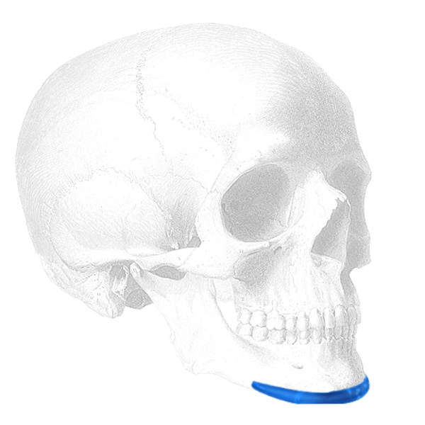 Implantech Mandibular Pre Jowl® implant – Precise Medical Supplies